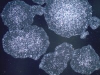 Simplicon® Human iPS Cell Line | SCC271